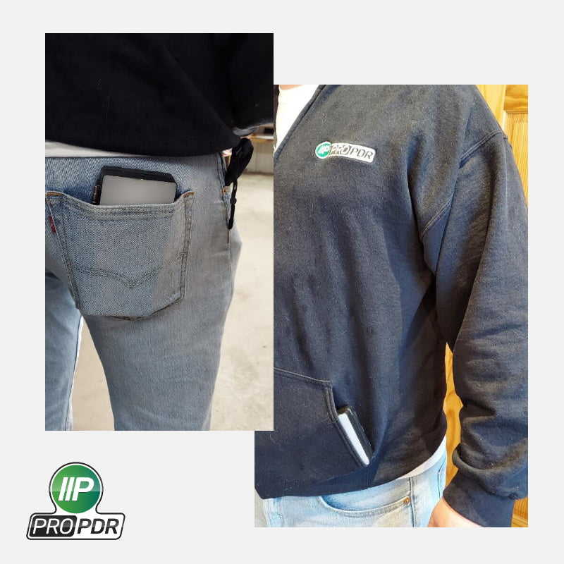 Chubby LED PDR Light - Pro PDR Solutions – Anson PDR